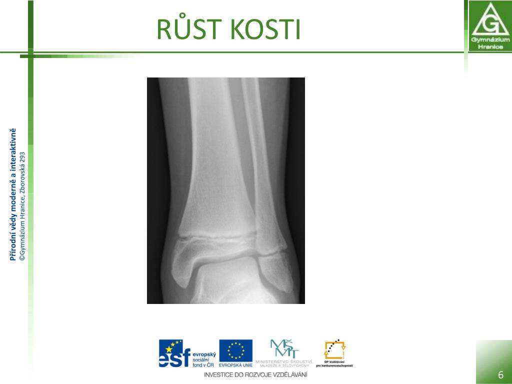 PPT - Opěrná soustava 2 stavba a růst kosti, první pomoc při ...