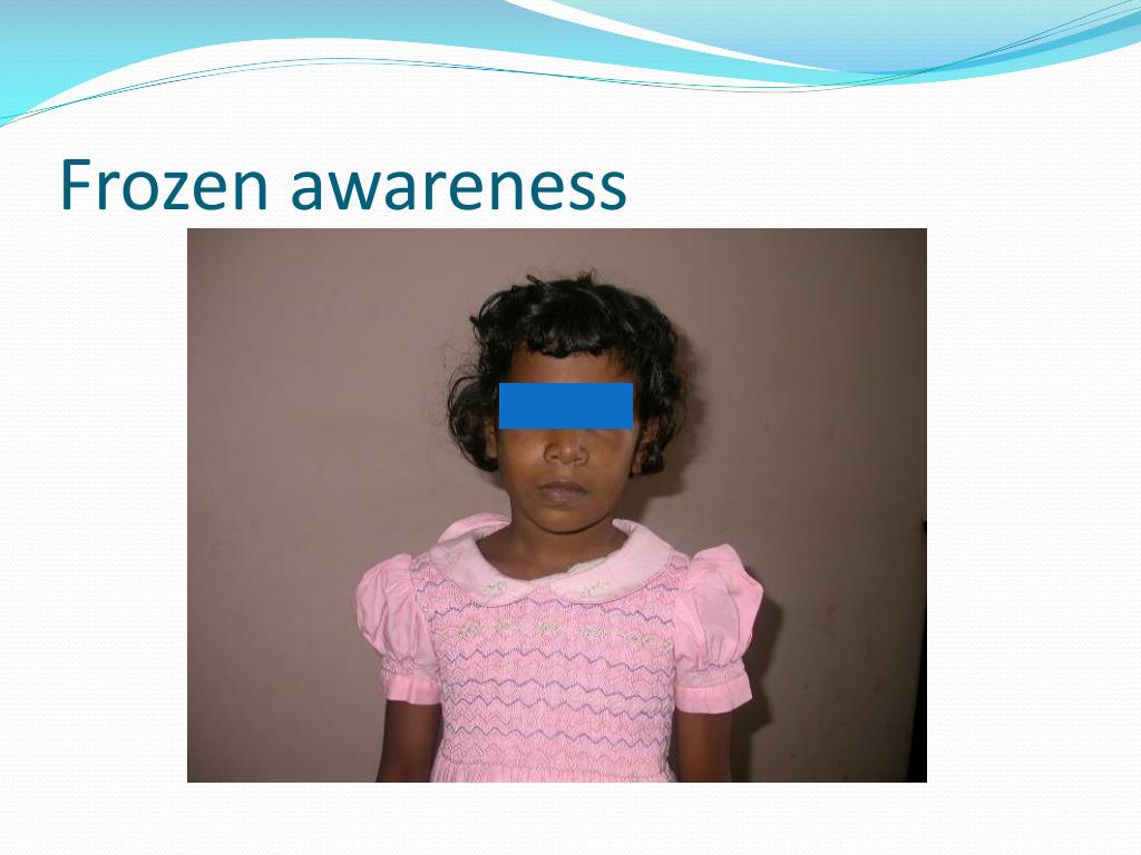PPT - Child abuse or Non-accidental Injury (NAI) in Children PowerPoint ...