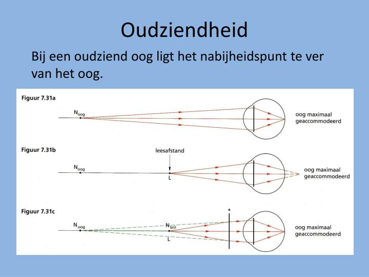 PPT - Oogafwijkingen PowerPoint Presentation - ID:3445901
