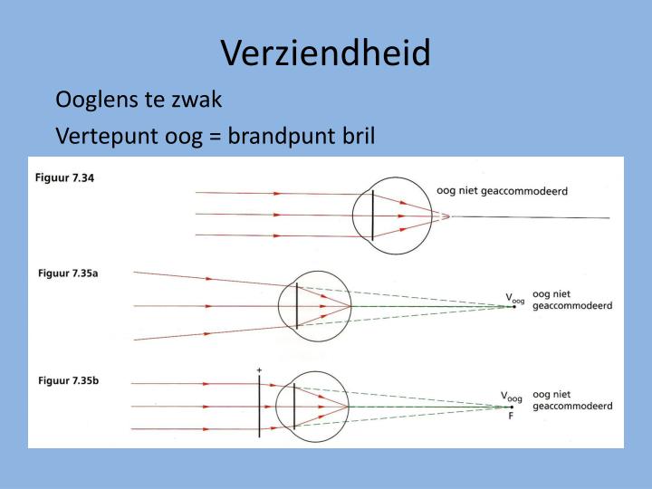 PPT - Oogafwijkingen PowerPoint Presentation - ID:3445901