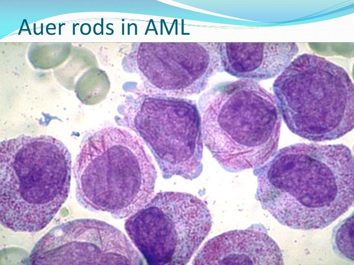 PPT - HEMATOPATHOLOGY. . PowerPoint Presentation - ID:3446723