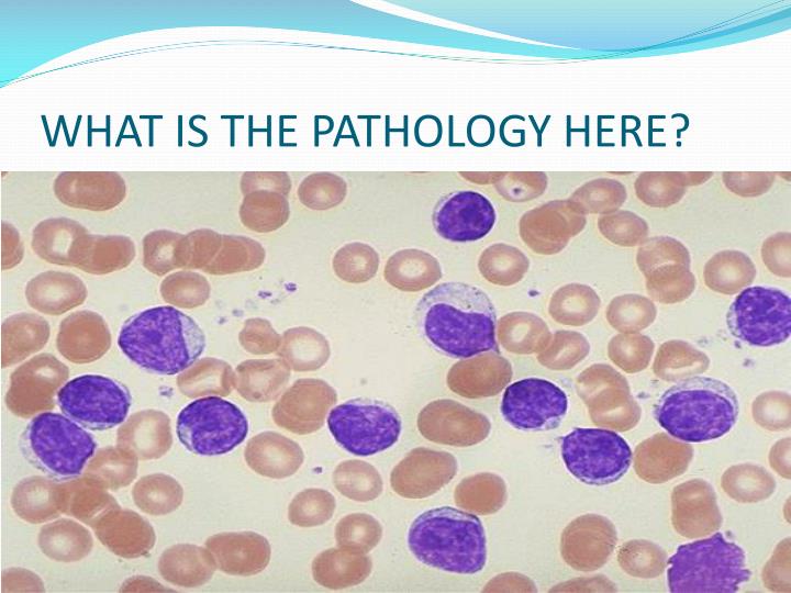 PPT - HEMATOPATHOLOGY. . PowerPoint Presentation - ID:3446723