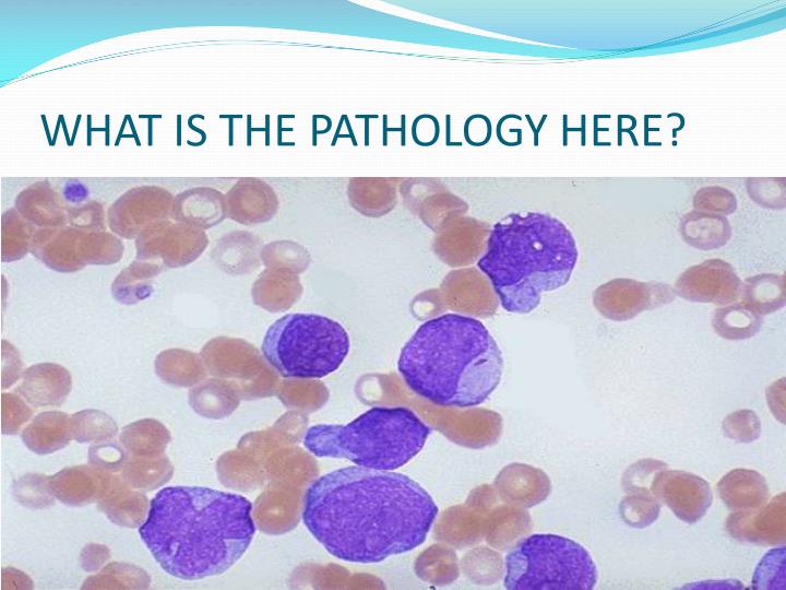 PPT - HEMATOPATHOLOGY. . PowerPoint Presentation - ID:3446723
