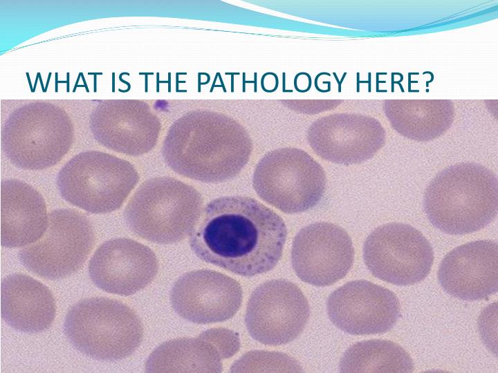 PPT - HEMATOPATHOLOGY. . PowerPoint Presentation - ID:3446723