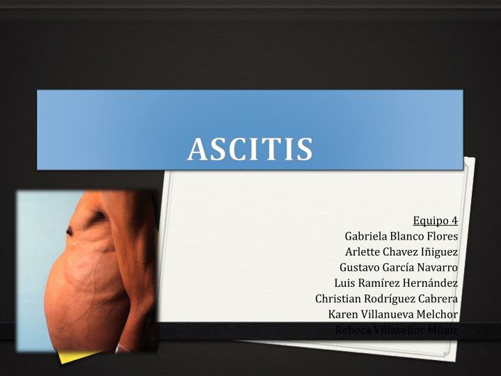 PPT - ASCITIS PowerPoint Presentation, free download - ID:3447695