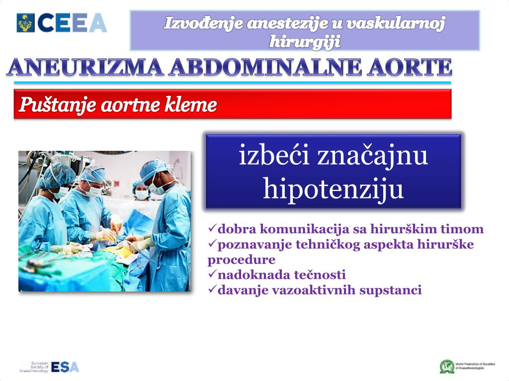 PPT - CEEA 2 : Kardiovaskularni sistem i anestezija Izvođenje ...