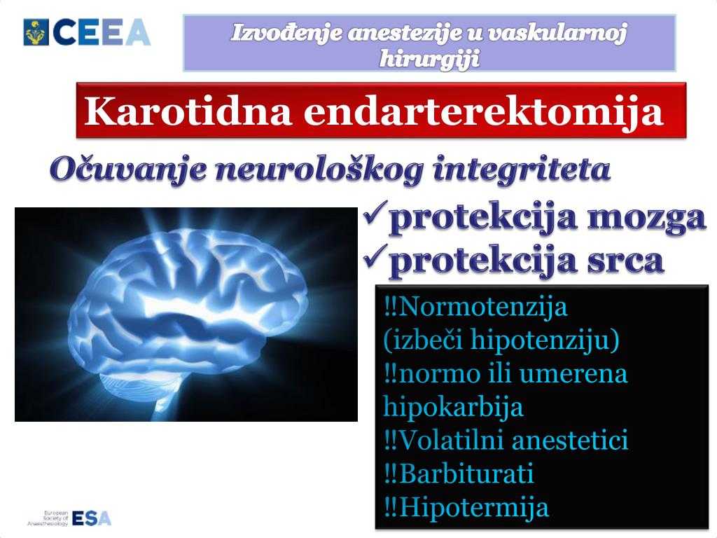 PPT - CEEA 2 : Kardiovaskularni sistem i anestezija Izvođenje ...