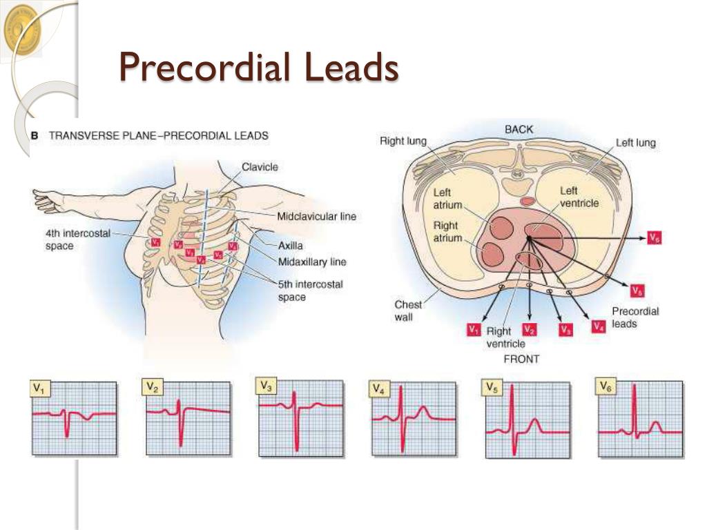 PPT - Electrocardiography-ECG/EKG PowerPoint Presentation, free ... PPT - Electrocardiography-ECG/EKG PowerPoint Presentation, free ...