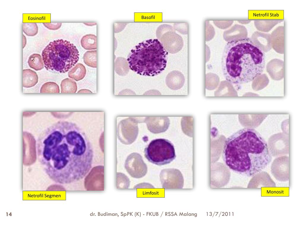 PPT - BONE MARROW ASPIRATION (Aspirasi sumsum tulang) PowerPoint ...