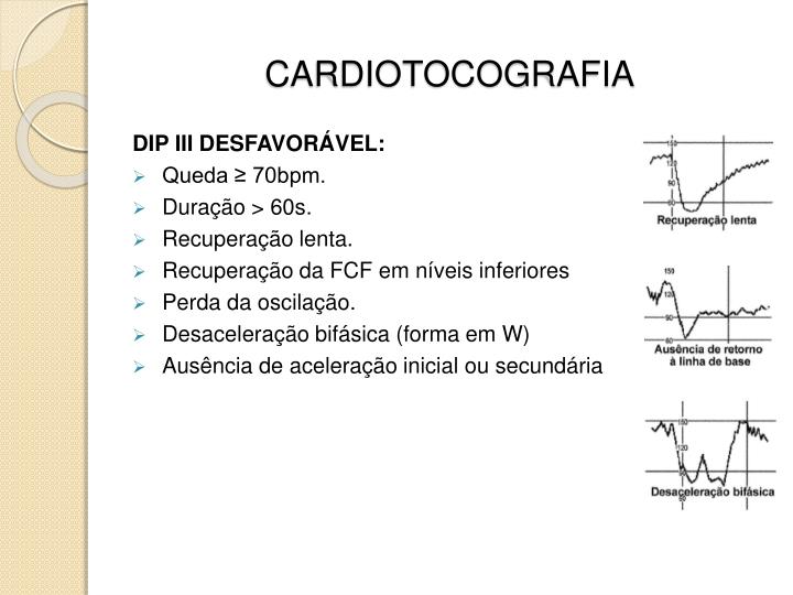 PPT - AVALIAÇÃO DA VITALIDADE FETAL PowerPoint Presentation - ID:3459942