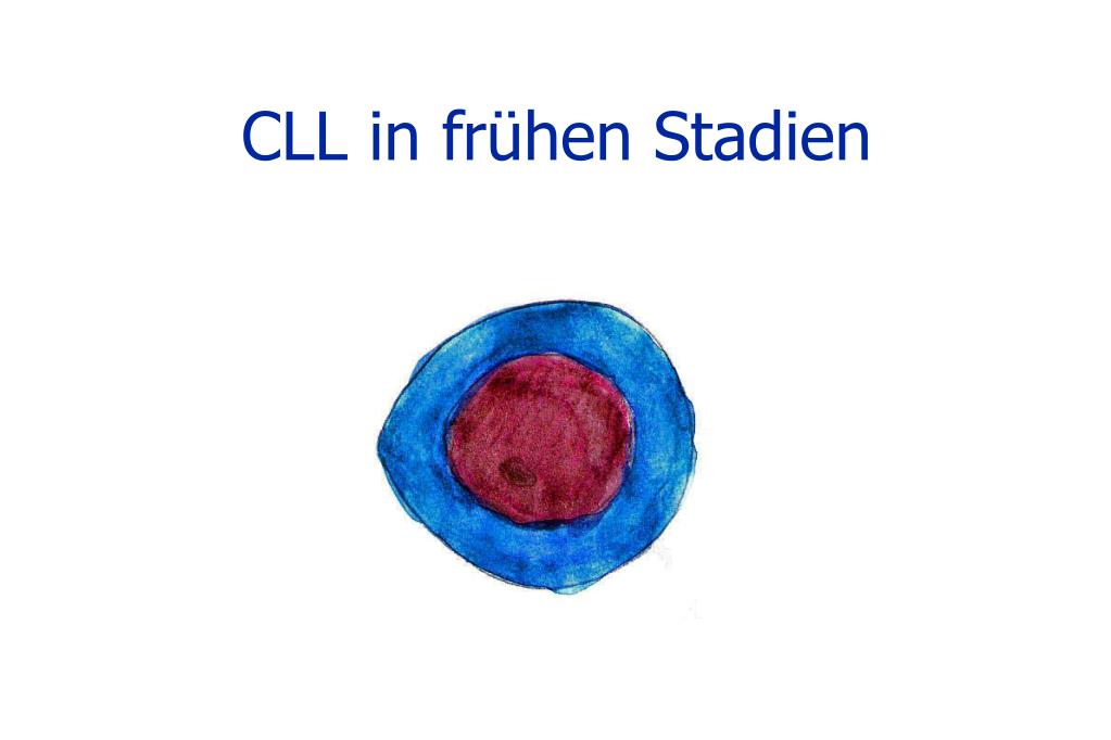 PPT - Chronische lymphatische Leukämie – Was ist neu? PowerPoint ...