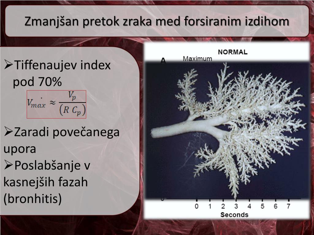 PPT - KOPB Kronična Obstruktivna Pljučna Bolezen PowerPoint ...