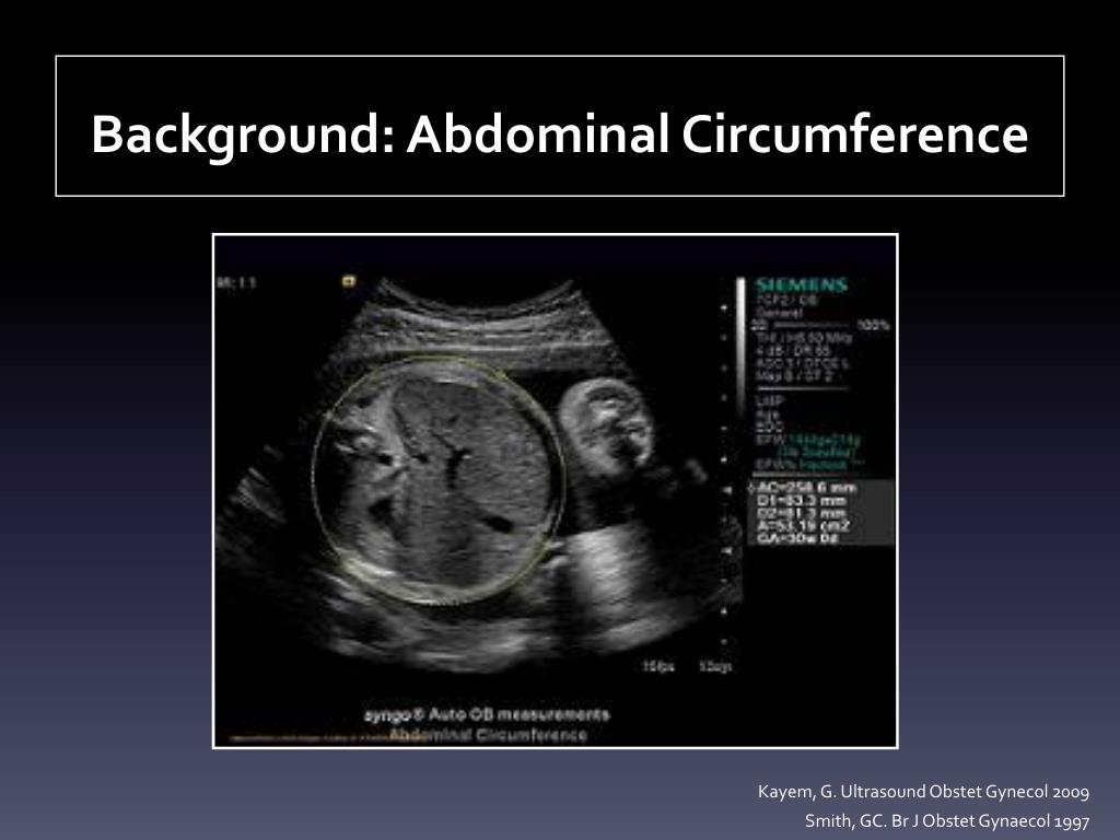 PPT - Adriane Haragan, MD Faculty Mentor: Gene Chang, MD PowerPoint ...