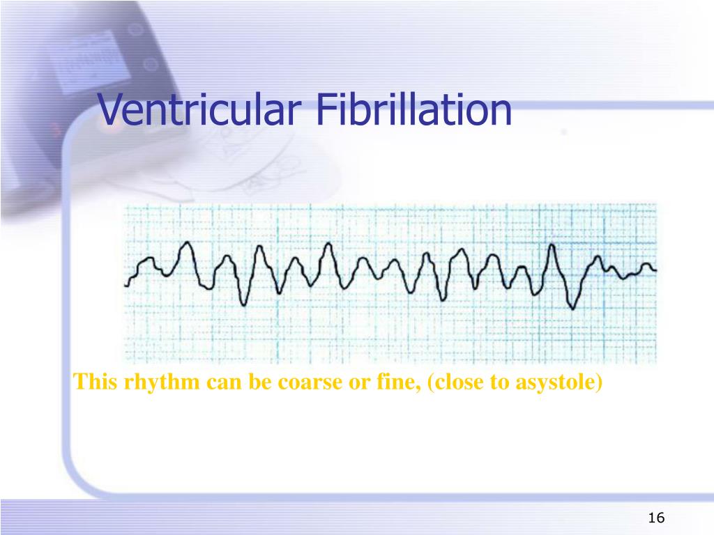 PPT - Electrical Treatment for Cardiac Abnormalities PowerPoint ...