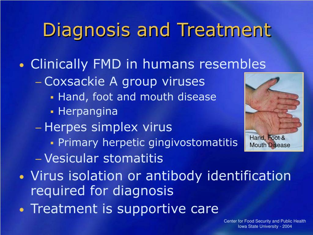 PPT - Foot and Mouth Disease PowerPoint Presentation, free download ...