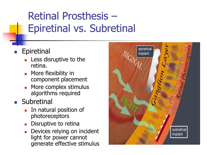 PPT - DOE Artificial Retina Program PowerPoint Presentation - ID:3472001
