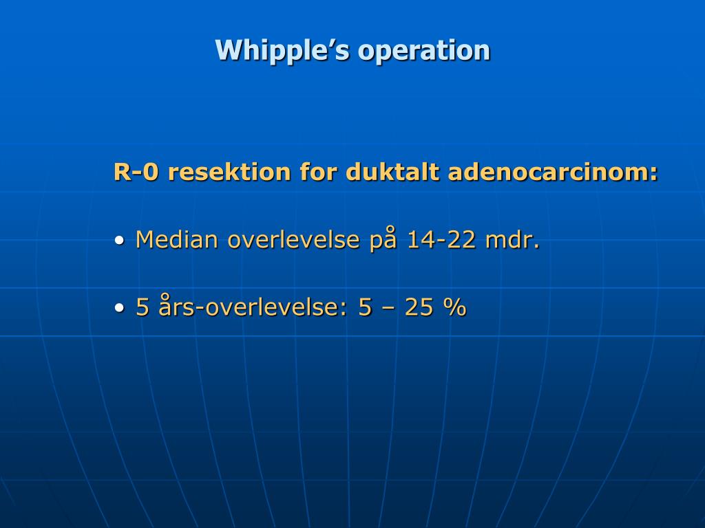 PPT - Cancer Pancreatis Diagnostik og behandling PowerPoint ...