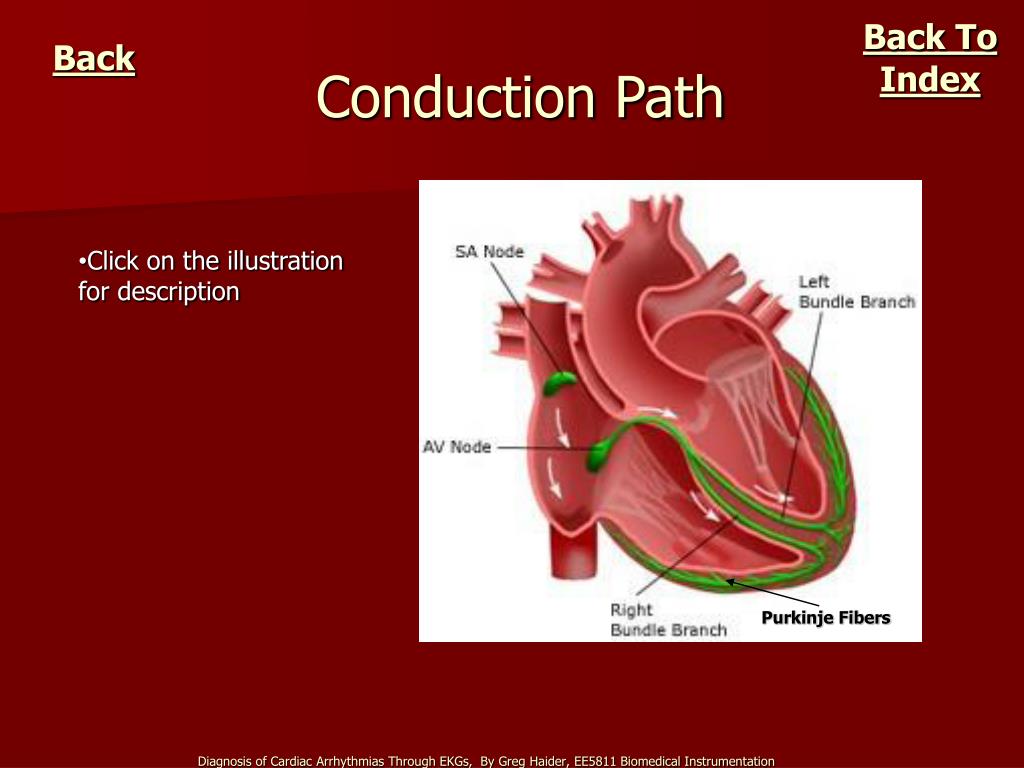 PPT - Diagnoses of Cardiac Arrhythmias Through Electrocardiographs ...