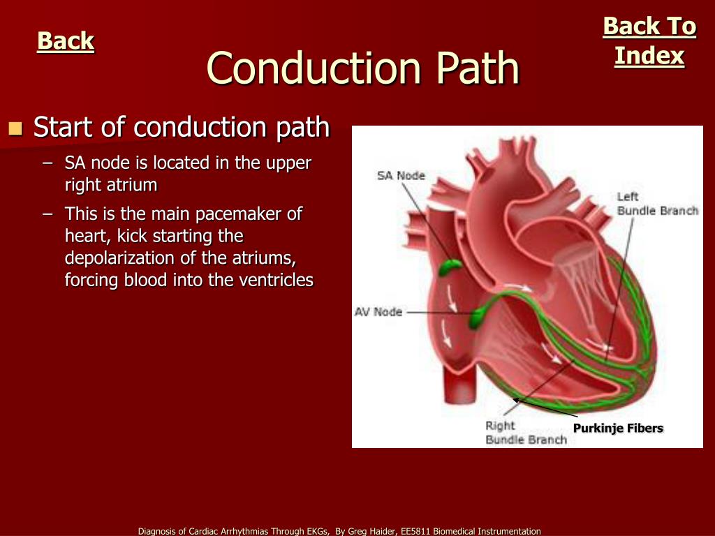 PPT - Diagnoses of Cardiac Arrhythmias Through Electrocardiographs ...