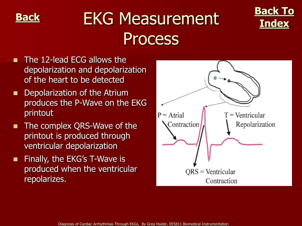 PPT - Diagnoses of Cardiac Arrhythmias Through Electrocardiographs ...