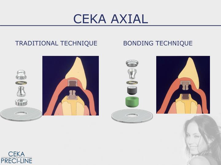 PPT - CEKA AXIAL PowerPoint Presentation, free download - ID:3473570