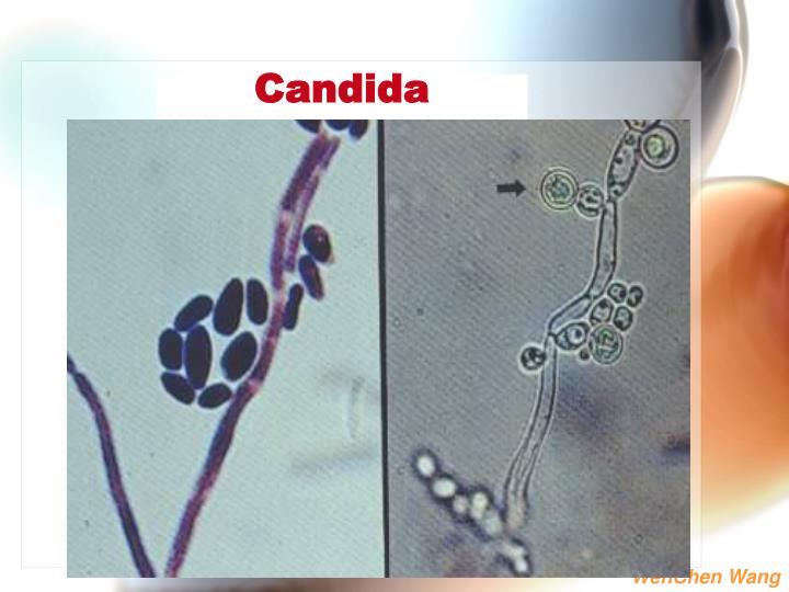 PPT - 1. White lesions of the oral mucosa 2. Solitary oral ulcer and ...
