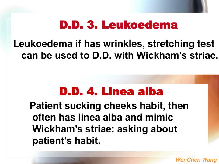 PPT - 1. White lesions of the oral mucosa 2. Solitary oral ulcer and ...