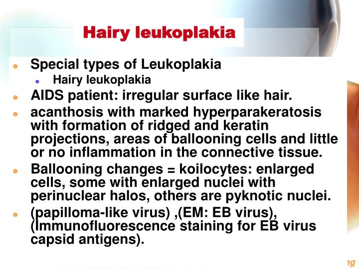 PPT - 1. White lesions of the oral mucosa 2. Solitary oral ulcer and ...