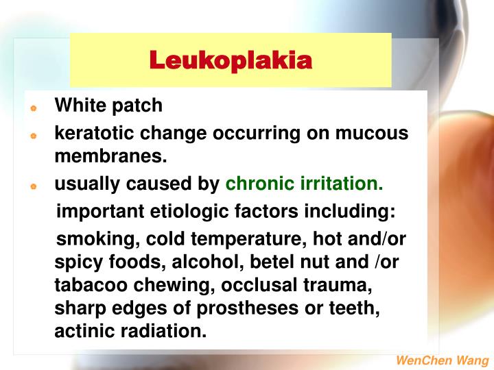 PPT - 1. White lesions of the oral mucosa 2. Solitary oral ulcer and ...