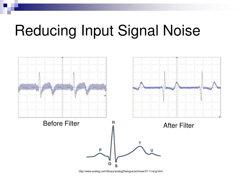 PPT - A Mobile Wireless Electrocardiogram System for Health Care ...