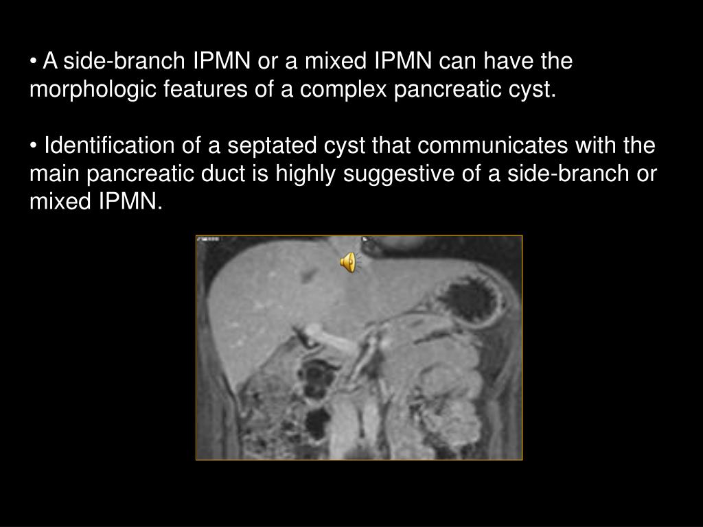 PPT - Imaging of Pancreatic Cystic Lesions PowerPoint Presentation ...