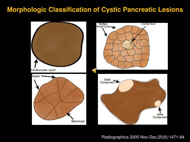 PPT - Imaging of Pancreatic Cystic Lesions PowerPoint Presentation - ID ...