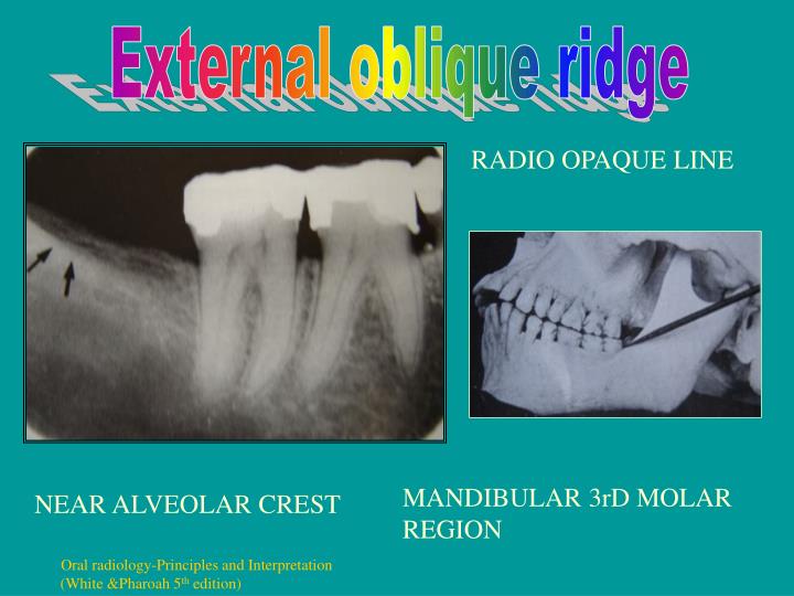PPT - NORMAL ANATOMICAL RADIOGRAPHIC LANDMARKS PowerPoint Presentation ...