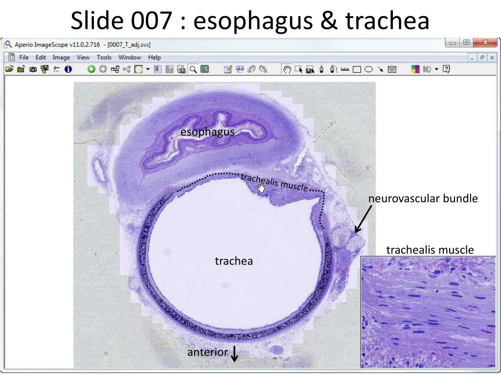 PPT - Nasal cavity, Pharynx and Larynx PowerPoint Presentation, free ...