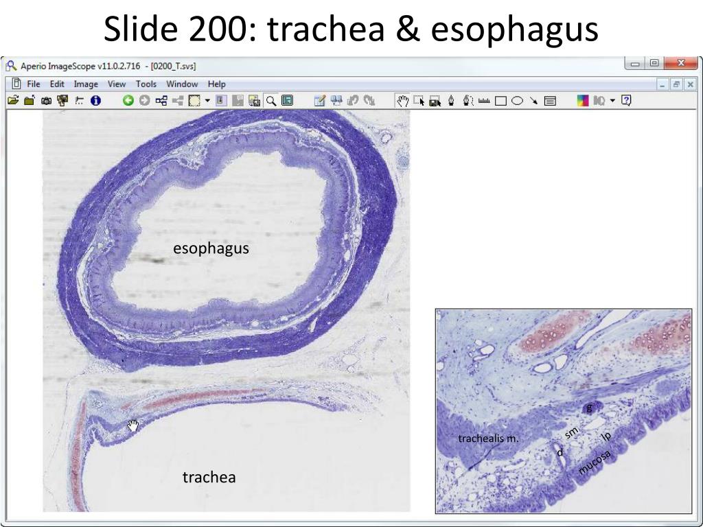 Trachea Esophagus Slide