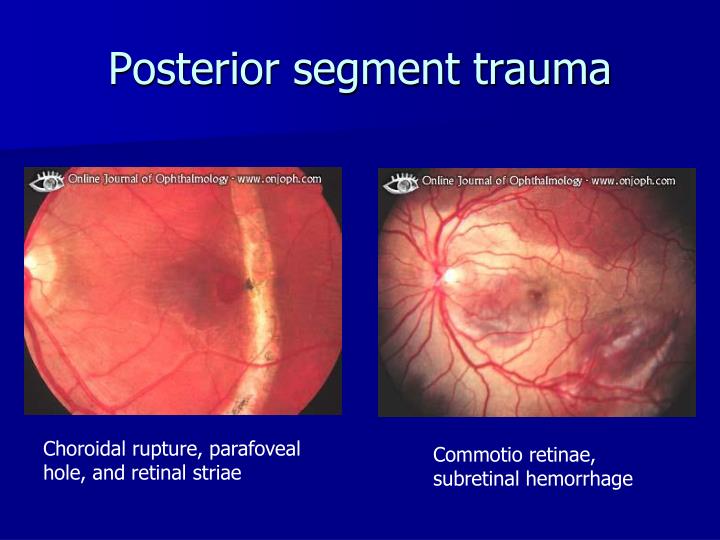 PPT - Ocular Emergencies: From A to Z PowerPoint Presentation - ID:3479447