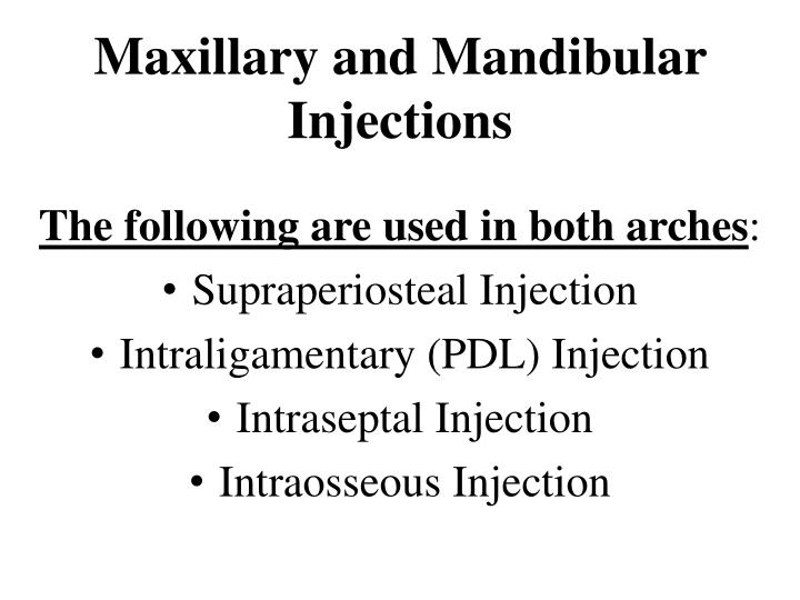PPT - Maxillary Injection Techniques PowerPoint Presentation - ID:3480977