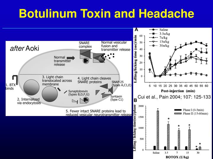 PPT - Migraine Pathophysiology An Update PowerPoint Presentation - ID ...