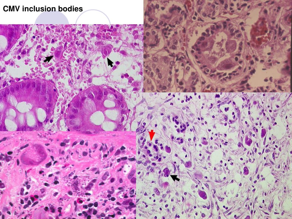 PPT - The Pathology of Viral Infections PowerPoint Presentation, free ...