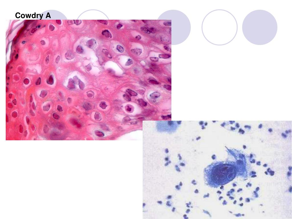 PPT - The Pathology of Viral Infections PowerPoint Presentation, free ...