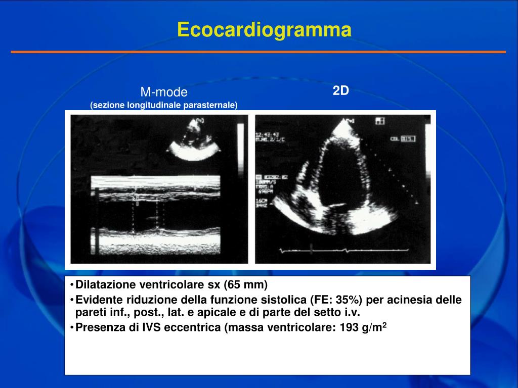 PPT - I sartani e il danno d’organo PowerPoint Presentation, free ...