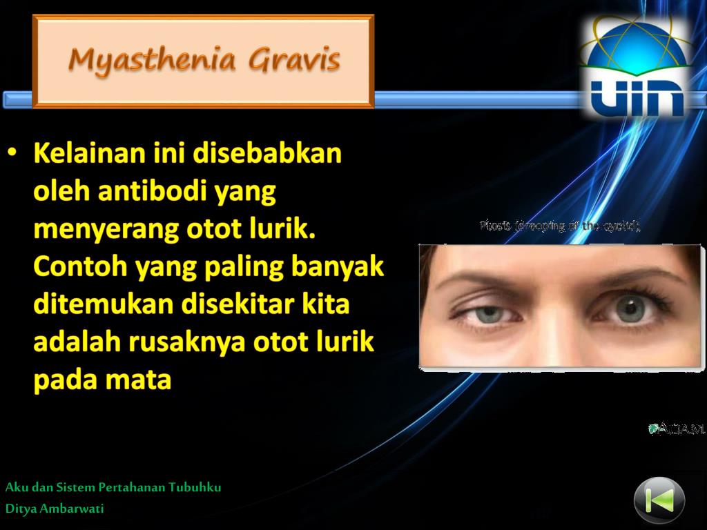 PPT - Aku dan Sistem Pertahanan Tubuhku By: Ditya Ambar PowerPoint Presentation - ID:3482670