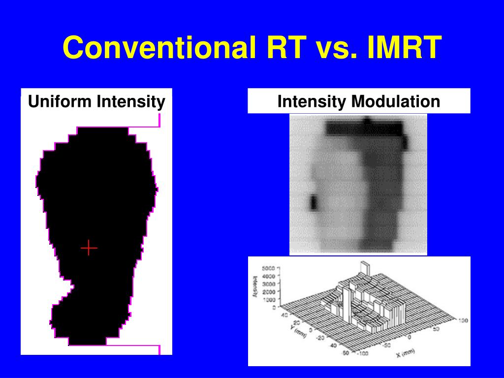 PPT - KM Alektiar, L Hong, MF Brennan, S Singer. Memorial Sloan ...