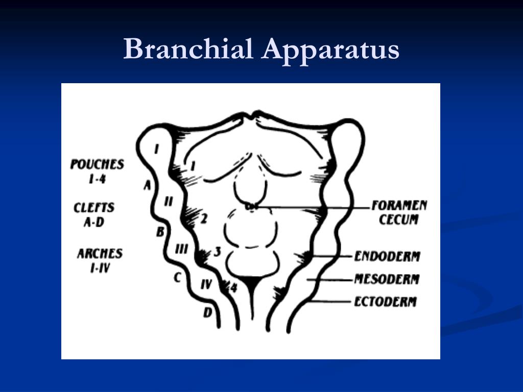 PPT - Pictoral Essay: Congenital Anomalies of the Branchial Apparatus ...