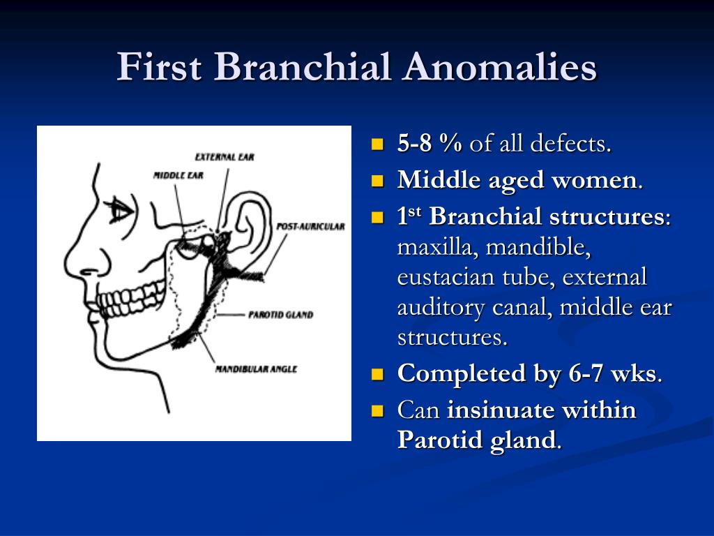 PPT - Pictoral Essay: Congenital Anomalies of the Branchial Apparatus ...