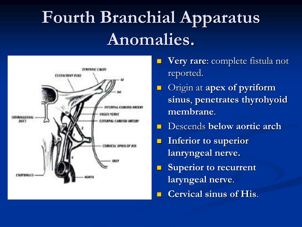 PPT - Pictoral Essay: Congenital Anomalies of the Branchial Apparatus ...