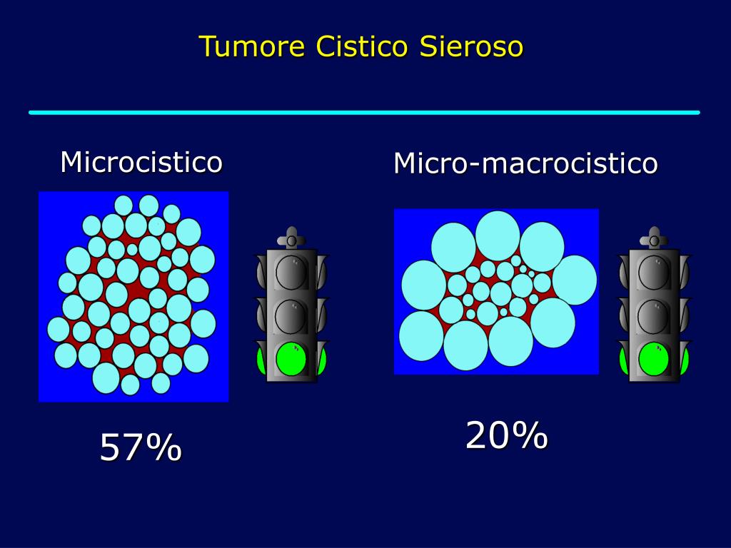 PPT - Tumori del pancreas: ruolo della chirurgia PowerPoint ...