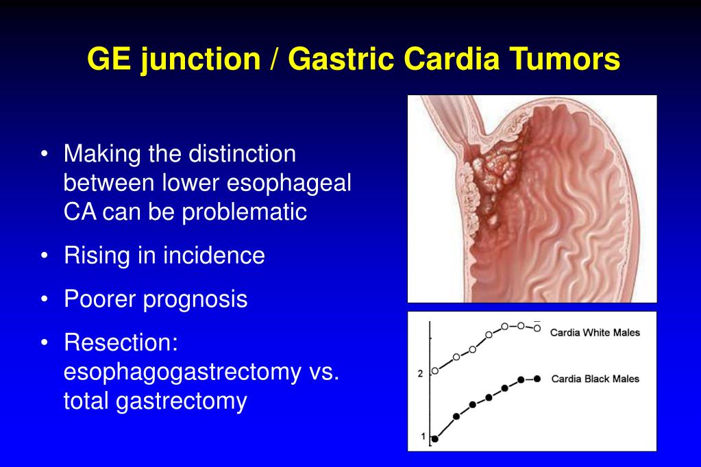 PPT - Michael A. Choti, MD Department of Surgery UT Southwestern ...