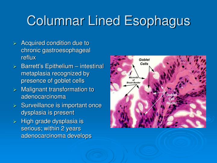 PPT - Thoracic Surgery Back to Basic PowerPoint Presentation - ID:3493483