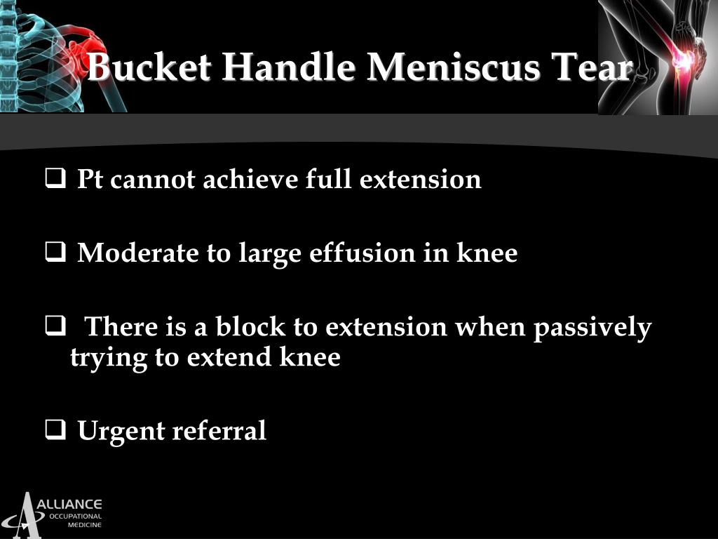 PPT - Shoulder and Knee Injury: Treatment and Prevention PowerPoint ...